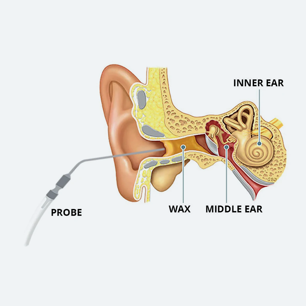 Ear toilet and suction - Manadr