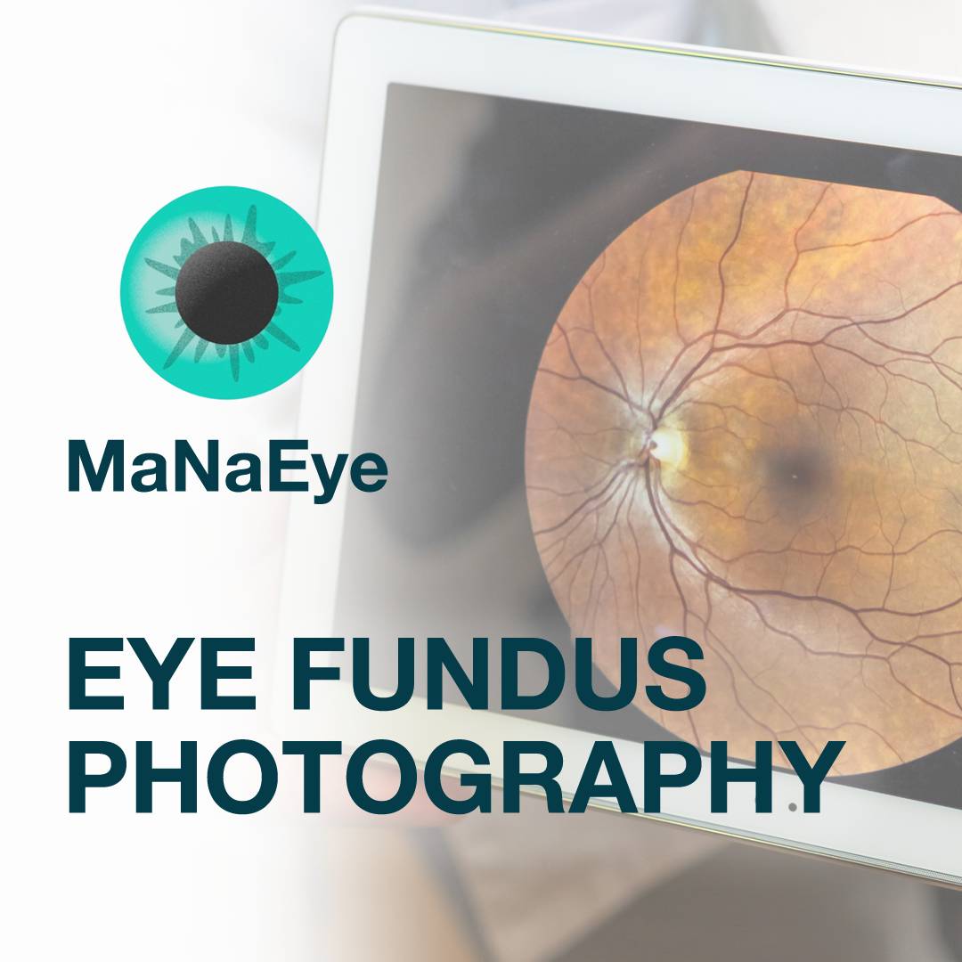 MaNaEye Eye Fundus Photography - Manadr